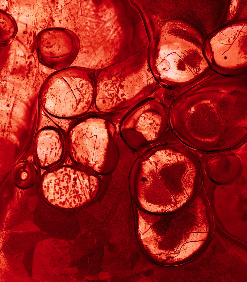 2014-12-10-Medische bubbels en nanodruppels - Science Café